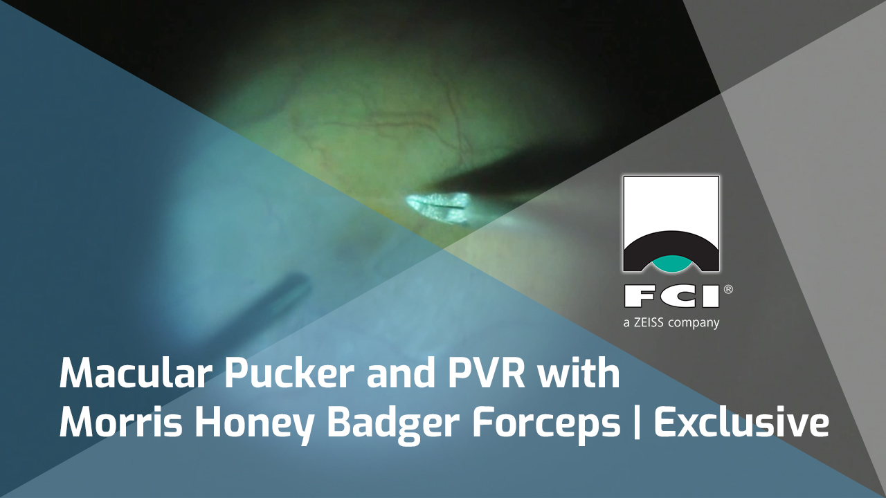 New Video | Macular Pucker and PVR with Morris Honey Badger Forceps - FCI