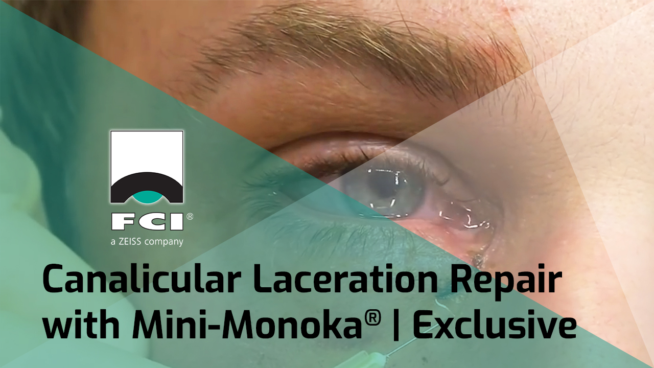 New Video | FCI’s Mini-Monoka® - FCI
