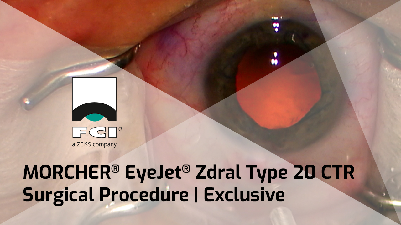 MORCHER® EyeJet® Zdral Type 20 CTR | Surgical Procedure | Exclusive - FCI