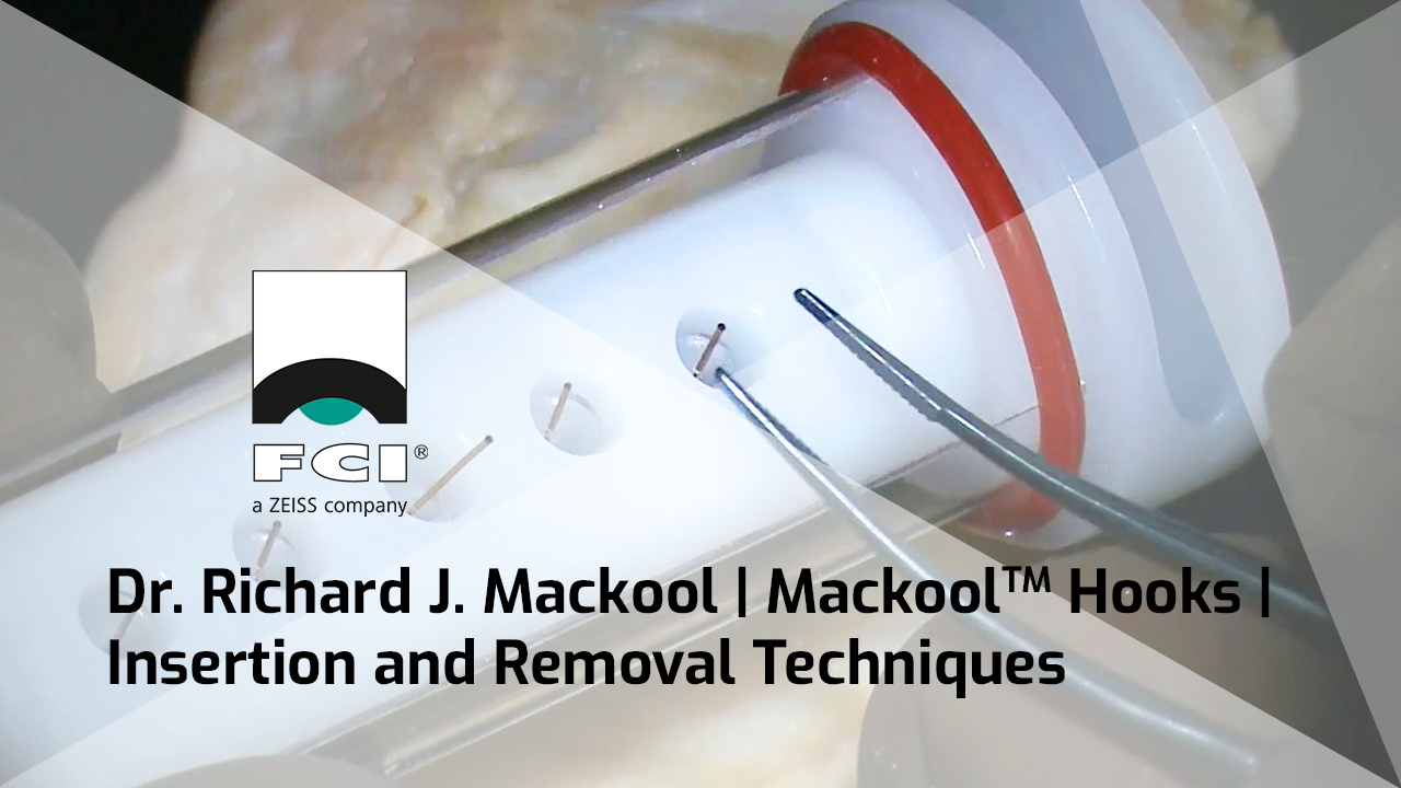 New Video | Dr. Richard J. Mackool | Mackool™ Hooks | Insertion and ...